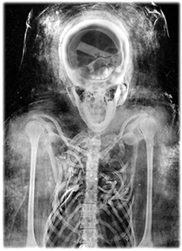 Photoshop Submission for 'Medical Anomalies' Contest | Design #9159899